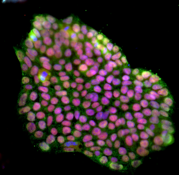 iPSC-Perturbation lab @ Medical College of Wisconsin